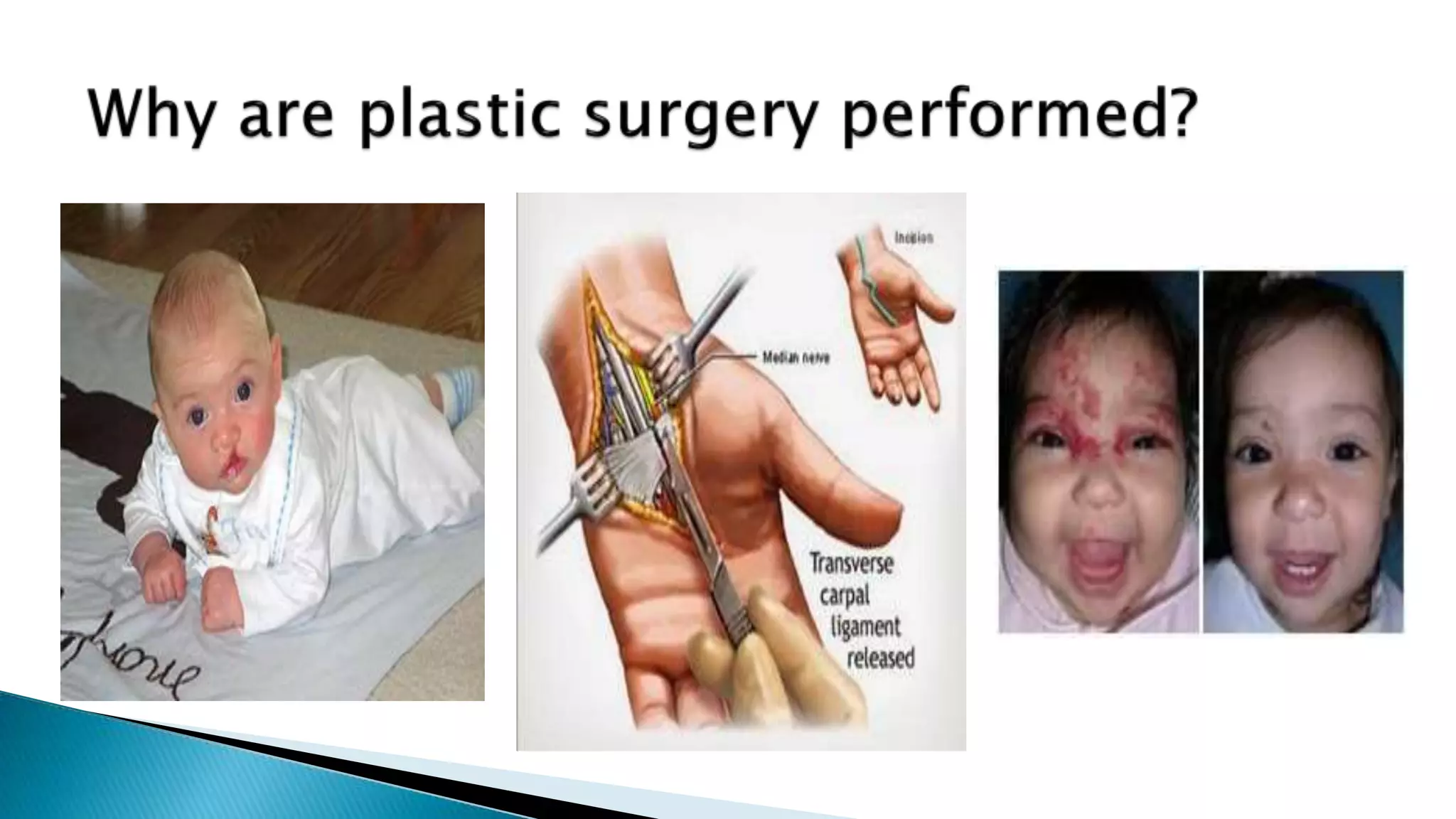 Biomaterials in plastic surgery | PPTX