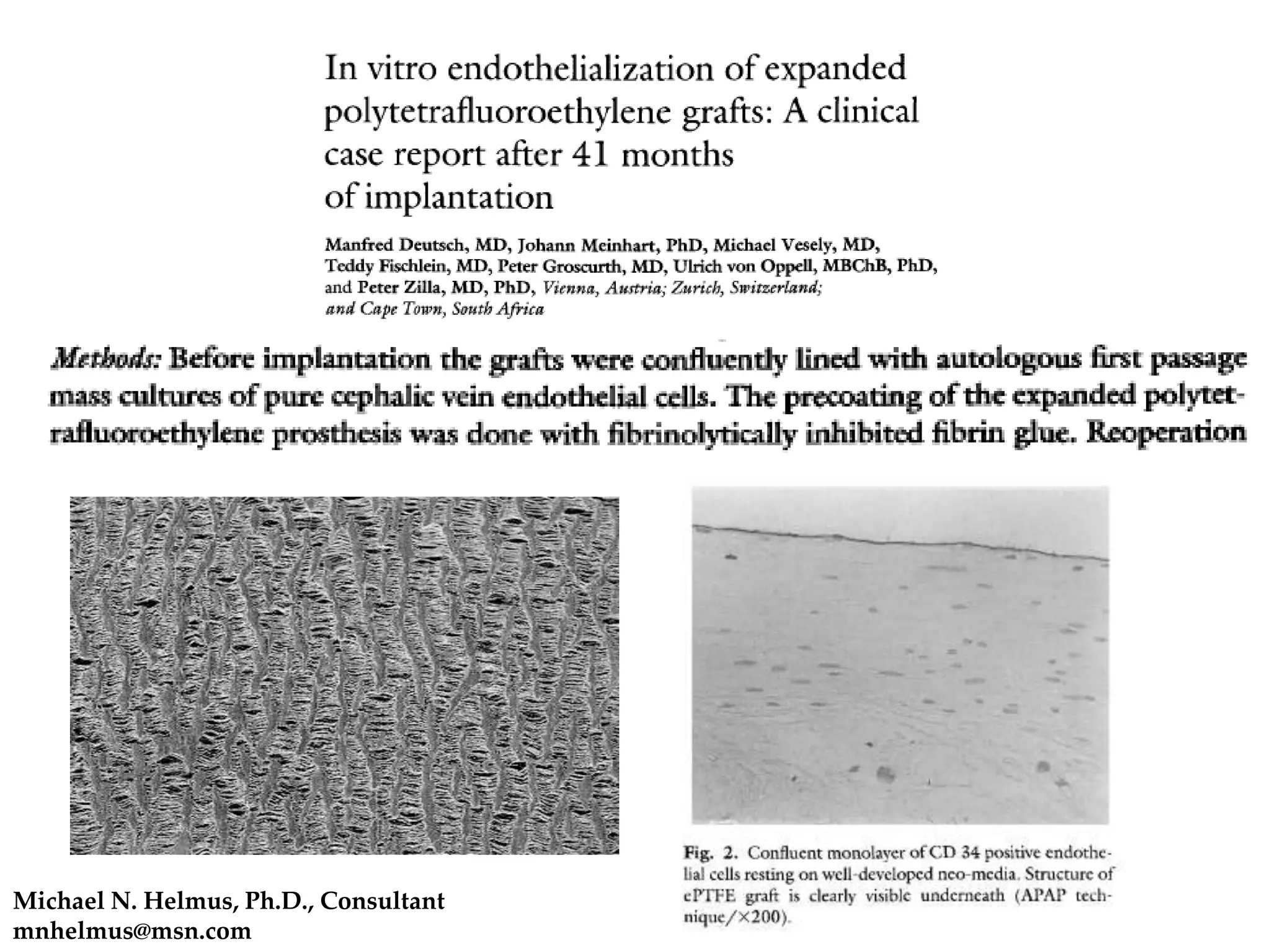 Biomaterials in the sustainability of regenerative medicine | PPT