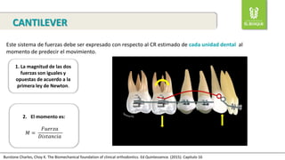 SISTEMAS ESTATICAMENTE DETERMINADOS (CANTILEVERS)- BIOMECANICA | PPTX