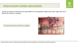 SISTEMAS ESTATICAMENTE DETERMINADOS (CANTILEVERS)- BIOMECANICA | PPTX