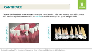 SISTEMAS ESTATICAMENTE DETERMINADOS (CANTILEVERS)- BIOMECANICA | PPTX
