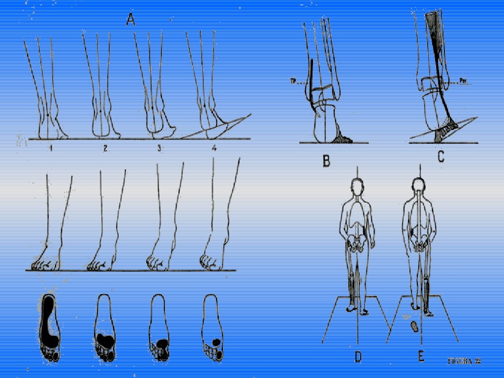 Biomecanica De La Marcha