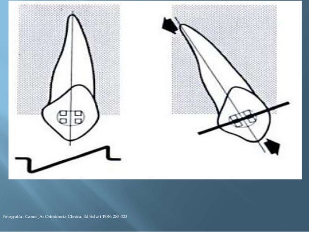 Biomecanica dobleces y torque.