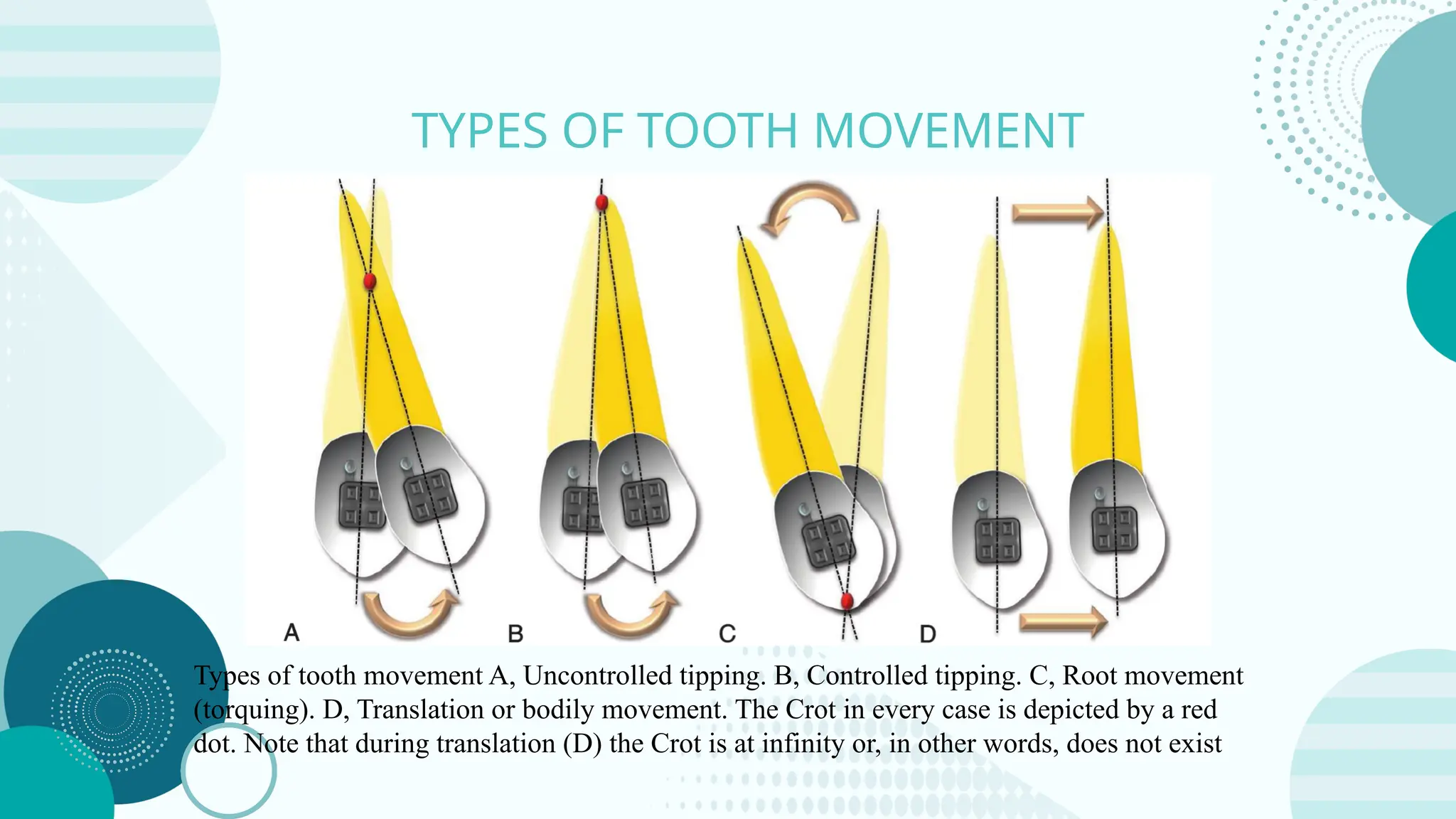 BIOMECHANICS IN ORTHODONTICS TREATMENTS | PPTX