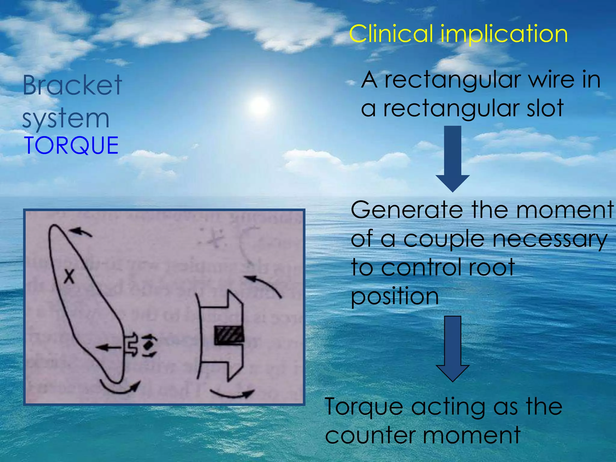 Biomechancs in Orthodotnics | PPTX