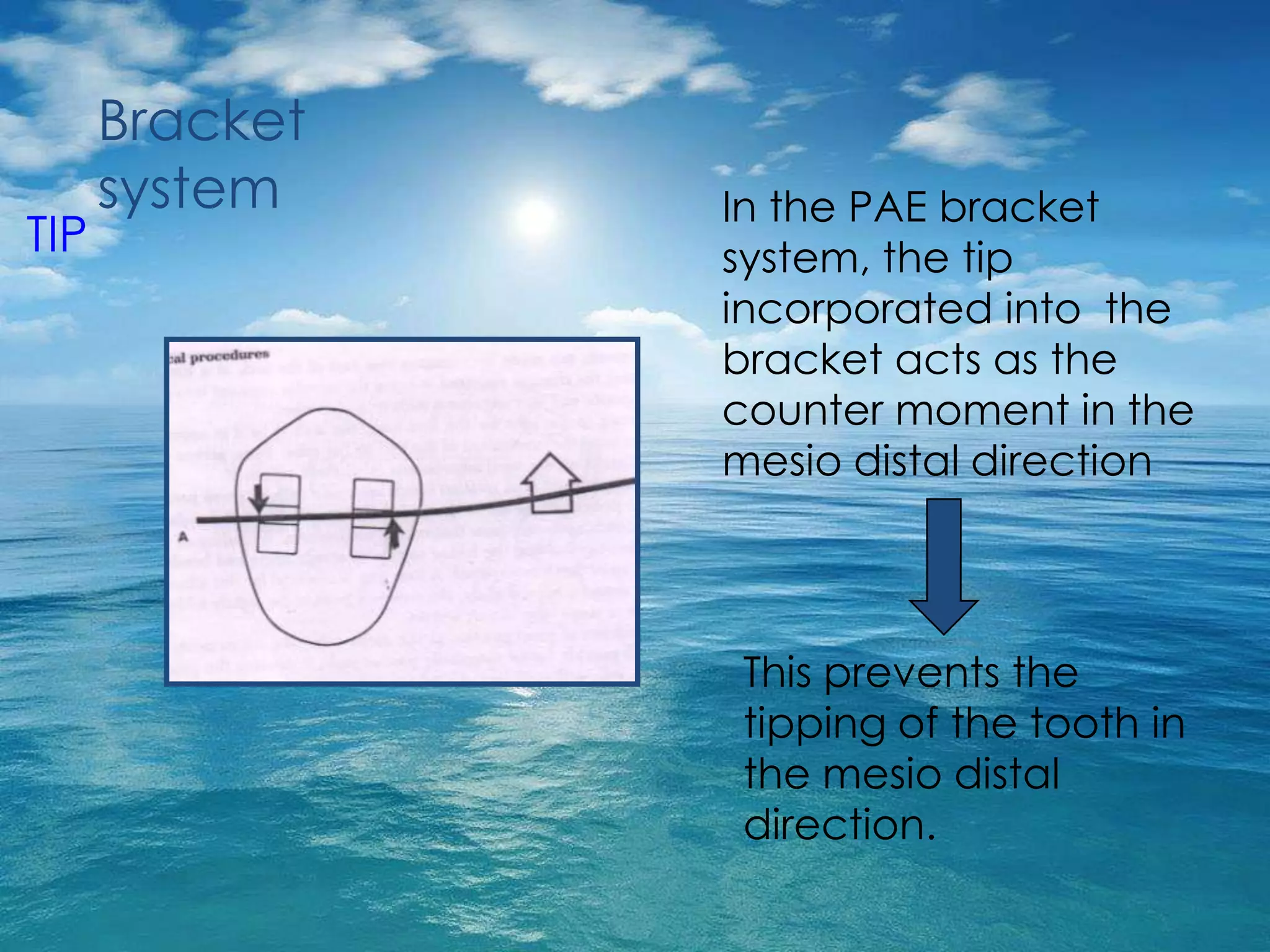 Biomechancs in Orthodotnics | PPTX