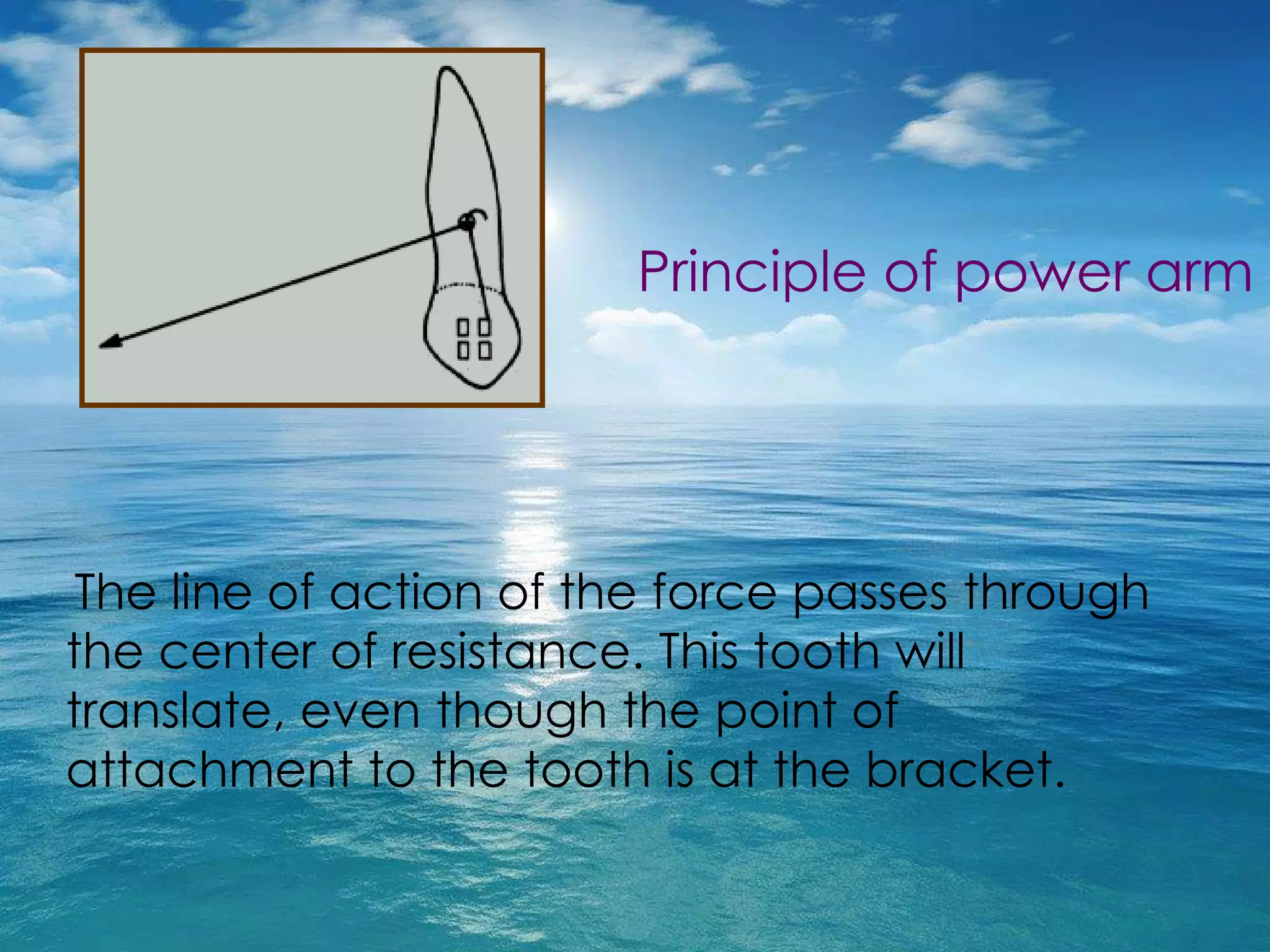 Biomechancs in Orthodotnics | PPTX