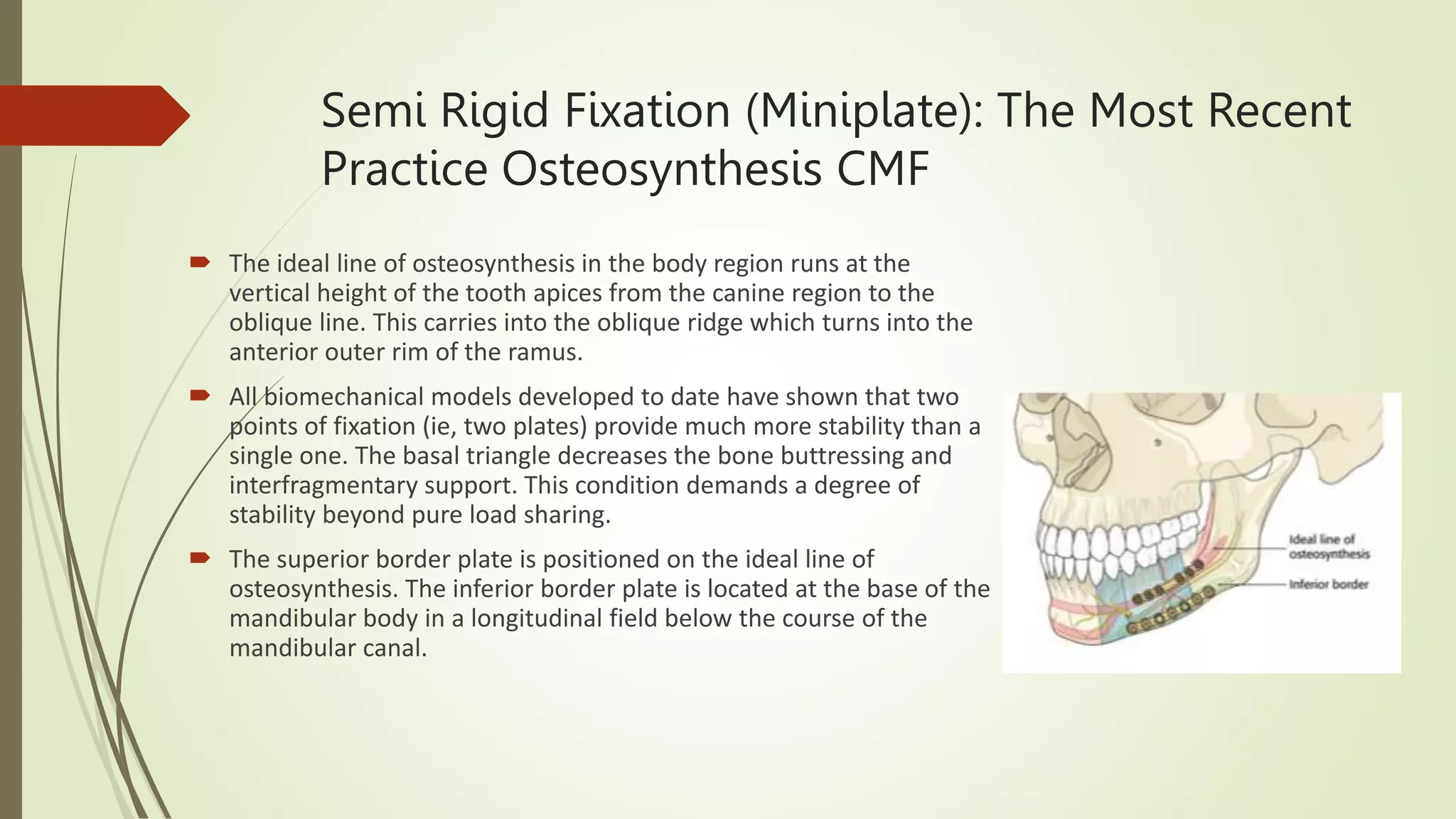 Biomechanical & Basic Principles CMF Osteosynthesis.pptx