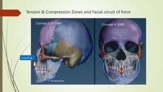 Biomechanical & Basic Principles CMF Osteosynthesis.pptx