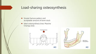 Biomechanical & Basic Principles CMF Osteosynthesis.pptx