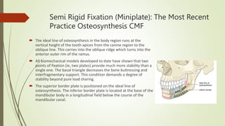 Biomechanical & Basic Principles CMF Osteosynthesis.pptx