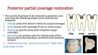 biomechanical consideration in partally coverage fixed prosthodontics.pptx