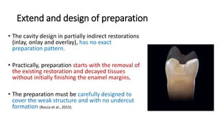 biomechanical consideration in partally coverage fixed prosthodontics.pptx