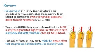biomechanical consideration in partally coverage fixed prosthodontics.pptx