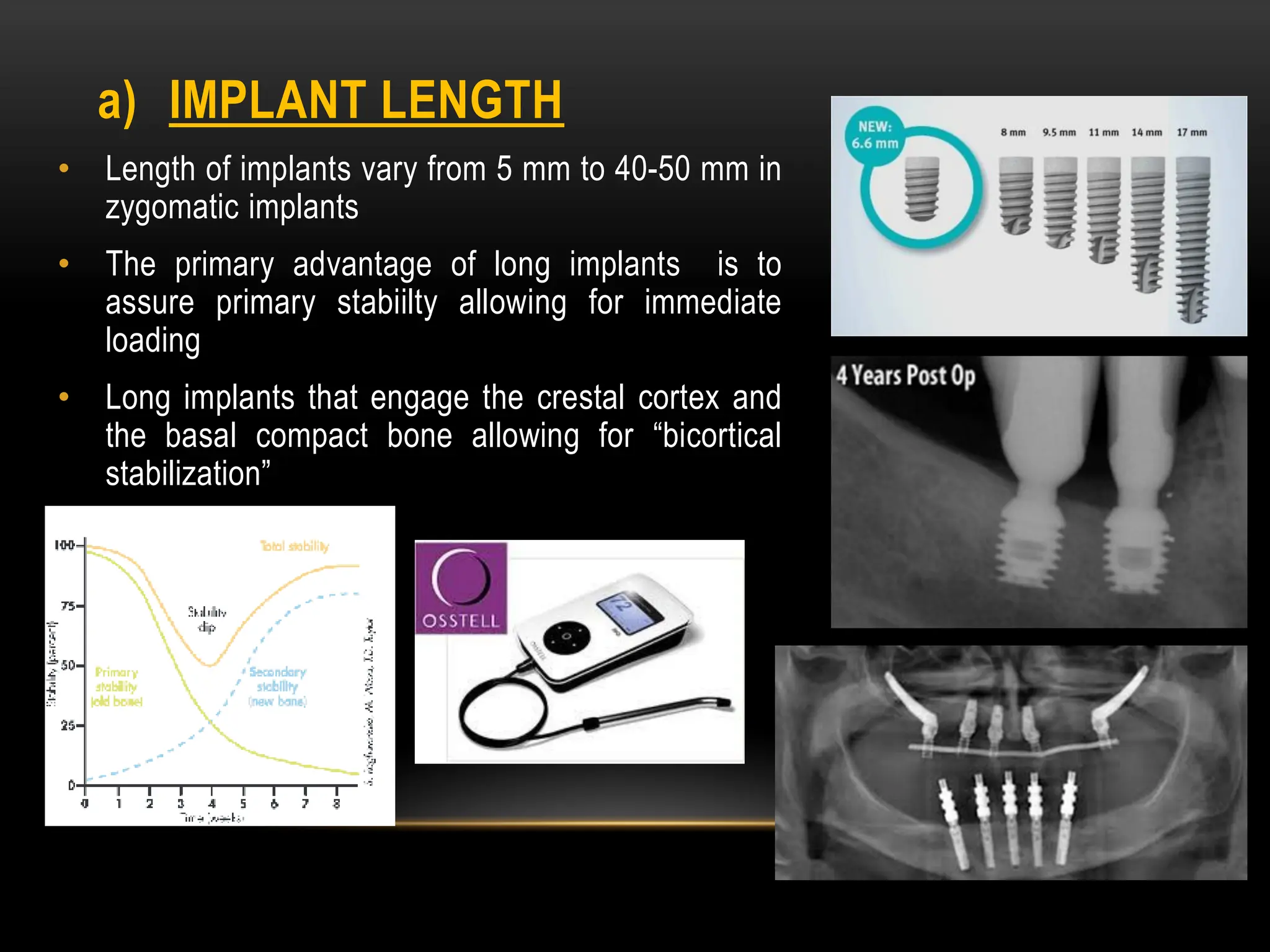 Biomechanical Considerations In Implant Dentistry.pdf