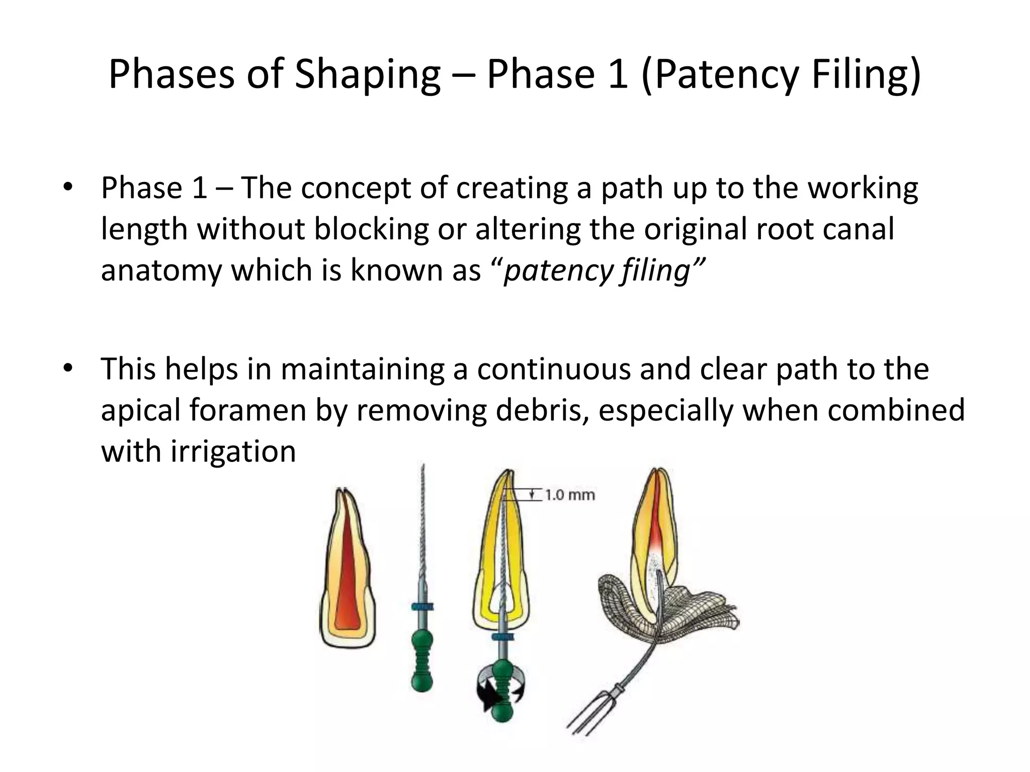 Biomechanical Preparation | PPTX