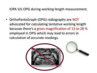 Biomechanical Preparation | PPTX