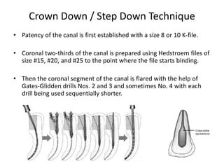 Biomechanical Preparation | PPTX