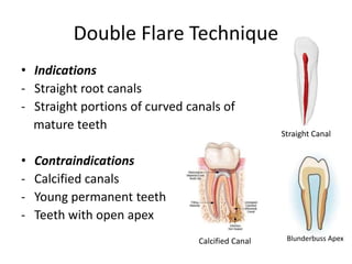 Biomechanical Preparation | PPTX