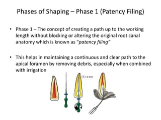 Biomechanical Preparation | PPTX