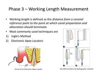 Biomechanical Preparation | PPTX
