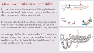 BIOMECHANICAL PRINCIPALS IN RPD IN PROSTHODONTICCS | PPTX