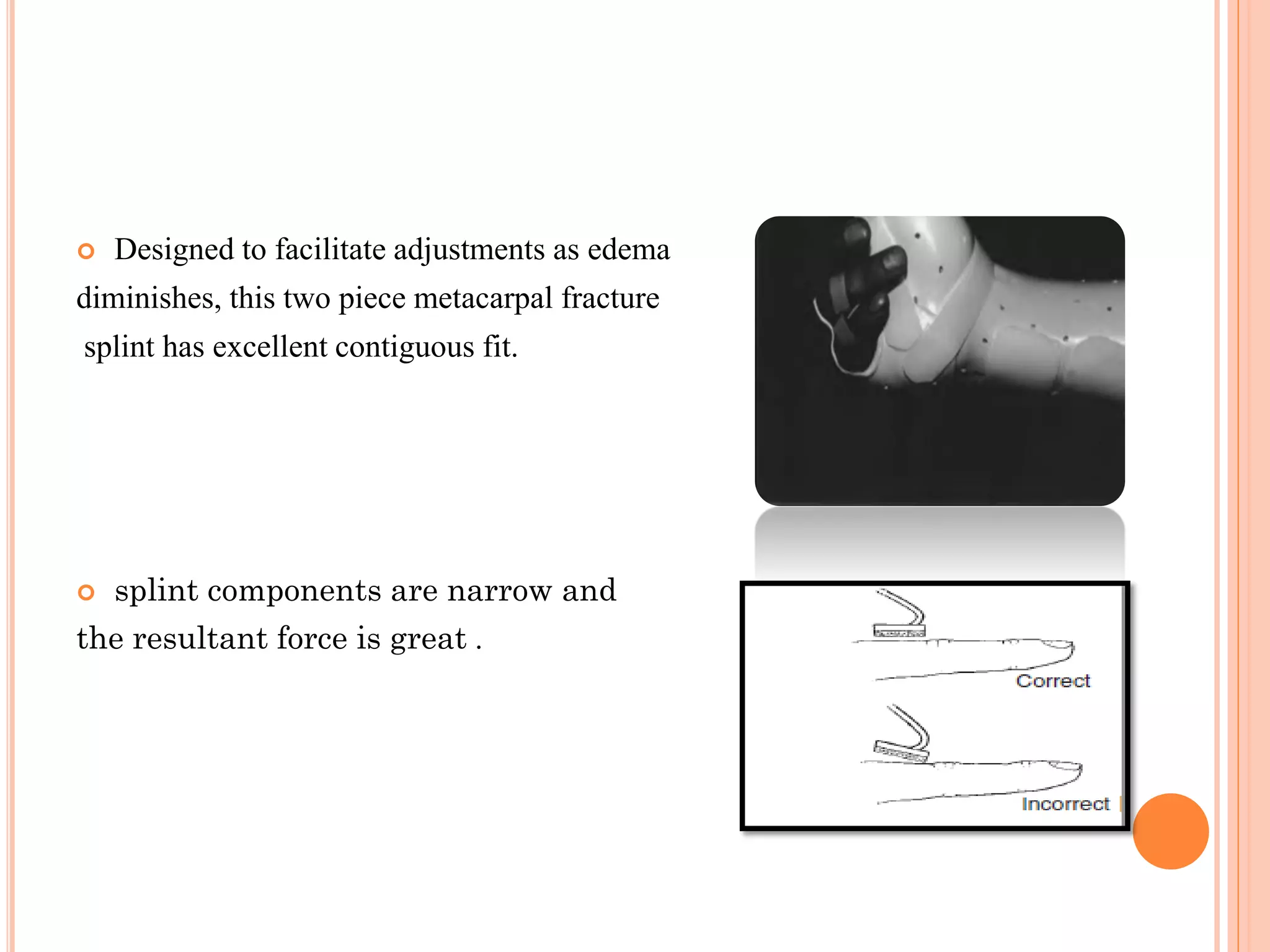 Biomechanical principle of hand splining | PDF