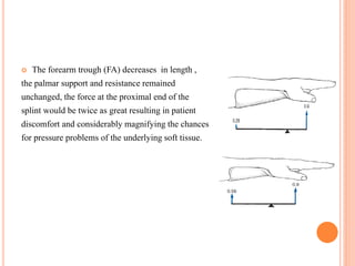 Biomechanical principle of hand splining | PDF