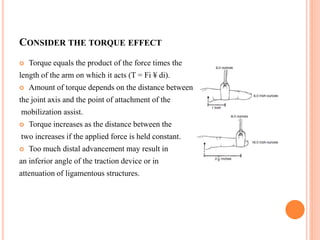 Biomechanical principle of hand splining | PDF