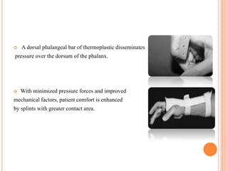 Biomechanical principle of hand splining | PDF