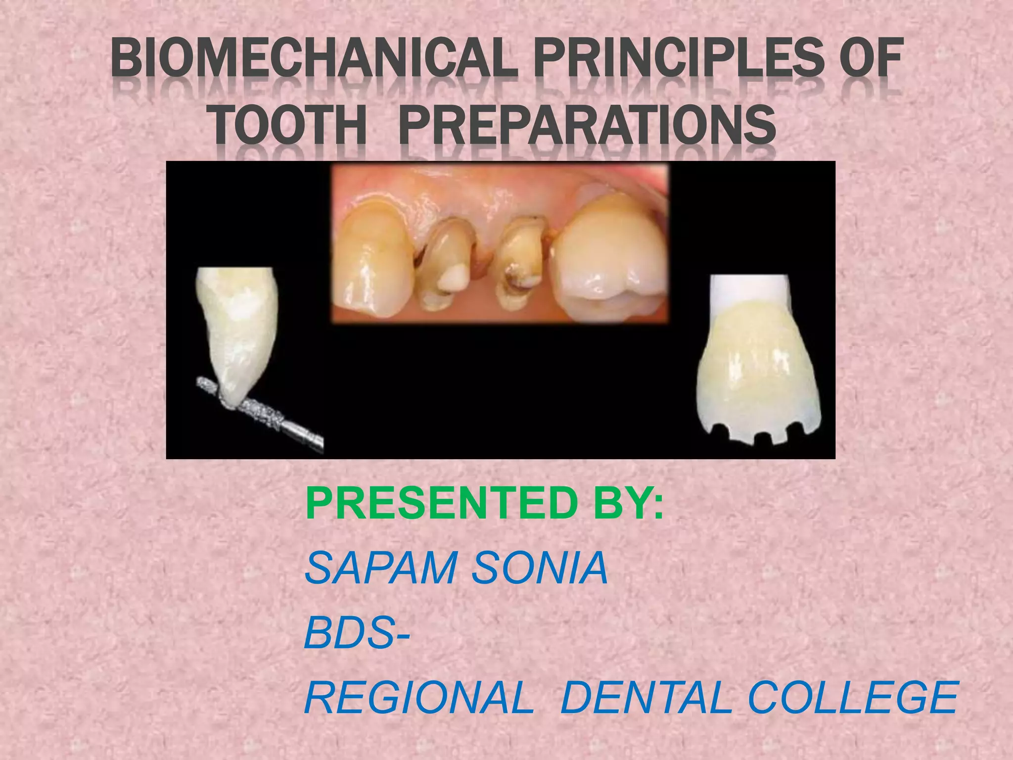 Biomechanical principles of TOOTH PREPARATION | PPTX