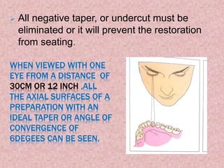 Biomechanical principles of TOOTH PREPARATION | PPTX