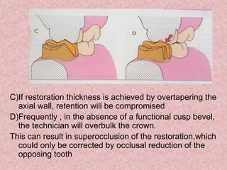 Biomechanical principles of TOOTH PREPARATION | PPTX