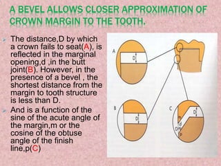 Biomechanical principles of TOOTH PREPARATION | PPTX
