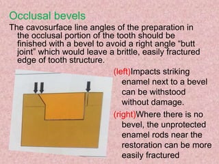 Biomechanical principles of TOOTH PREPARATION | PPTX