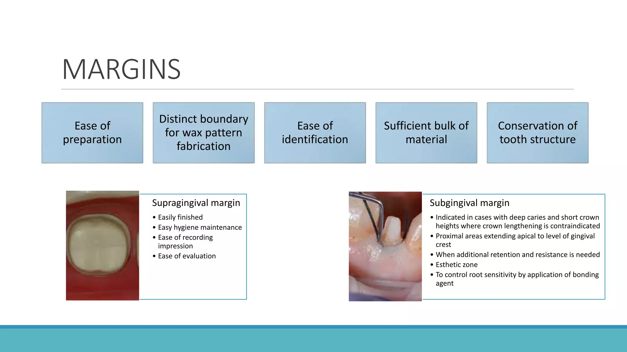 BIOMECHANICAL PRINCIPLES OF TOOTH PREPARATION | PPTX
