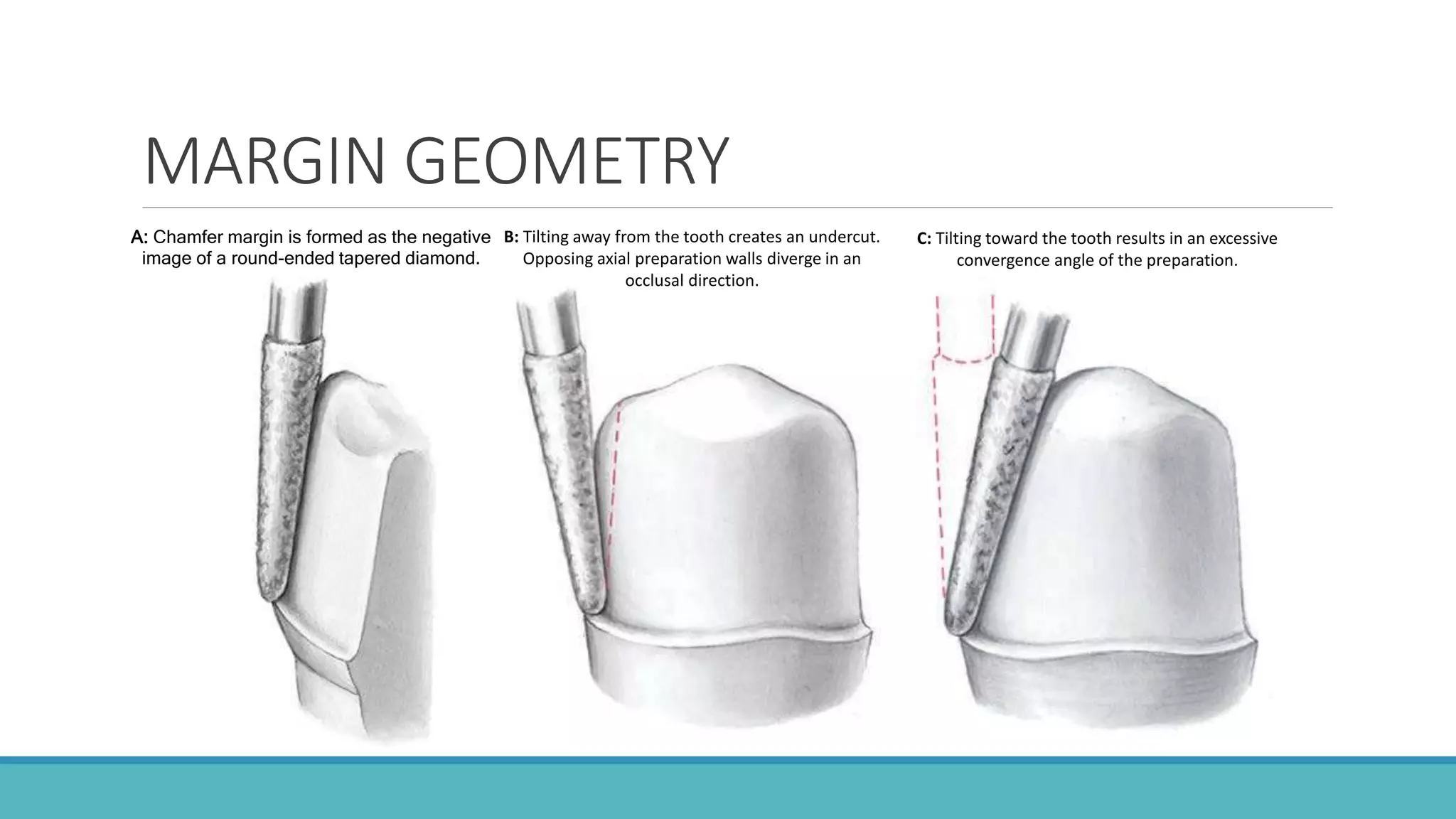 BIOMECHANICAL PRINCIPLES OF TOOTH PREPARATION | PPTX
