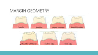 BIOMECHANICAL PRINCIPLES OF TOOTH PREPARATION | PPTX