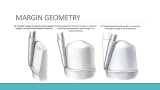 BIOMECHANICAL PRINCIPLES OF TOOTH PREPARATION | PPTX