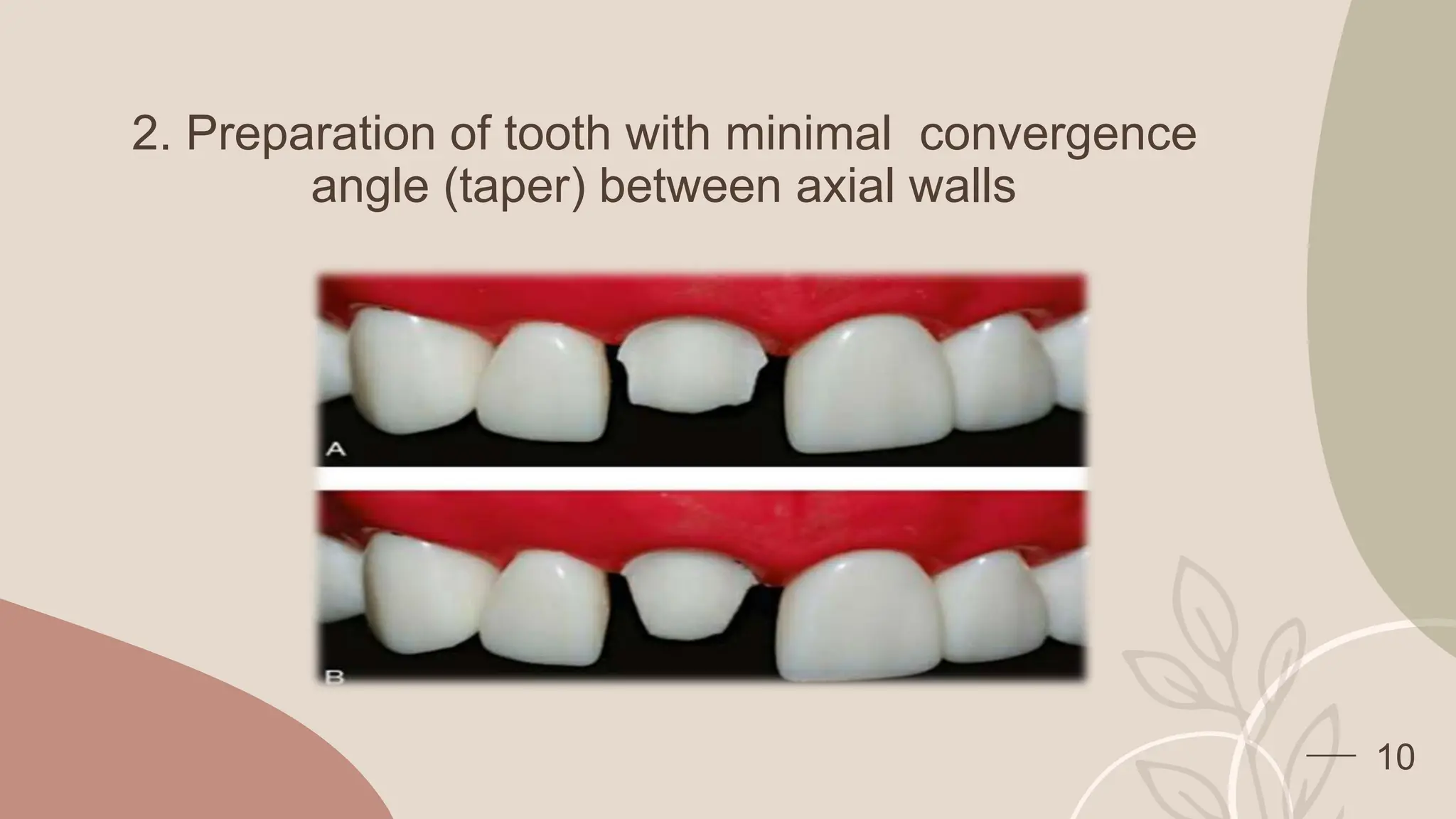 BIOMECHANICAL PRINCIPLES OF TOOTH PREPARATION.pptx