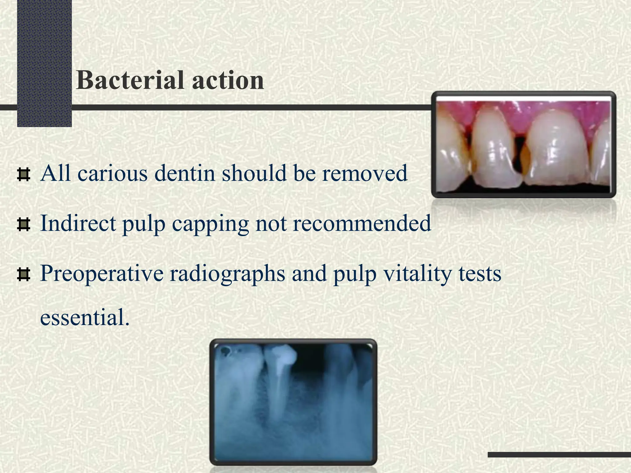 Biomechanical Principles of Tooth Preparation in FPD.ppt