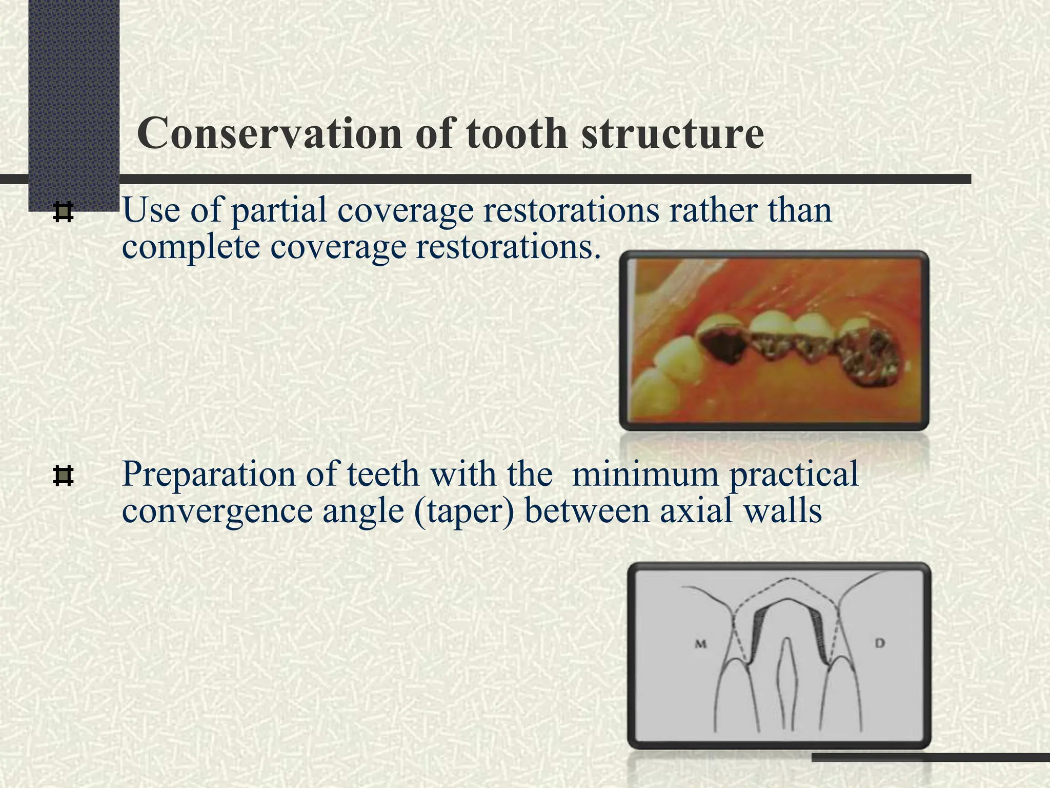 Biomechanical Principles of Tooth Preparation in FPD.ppt