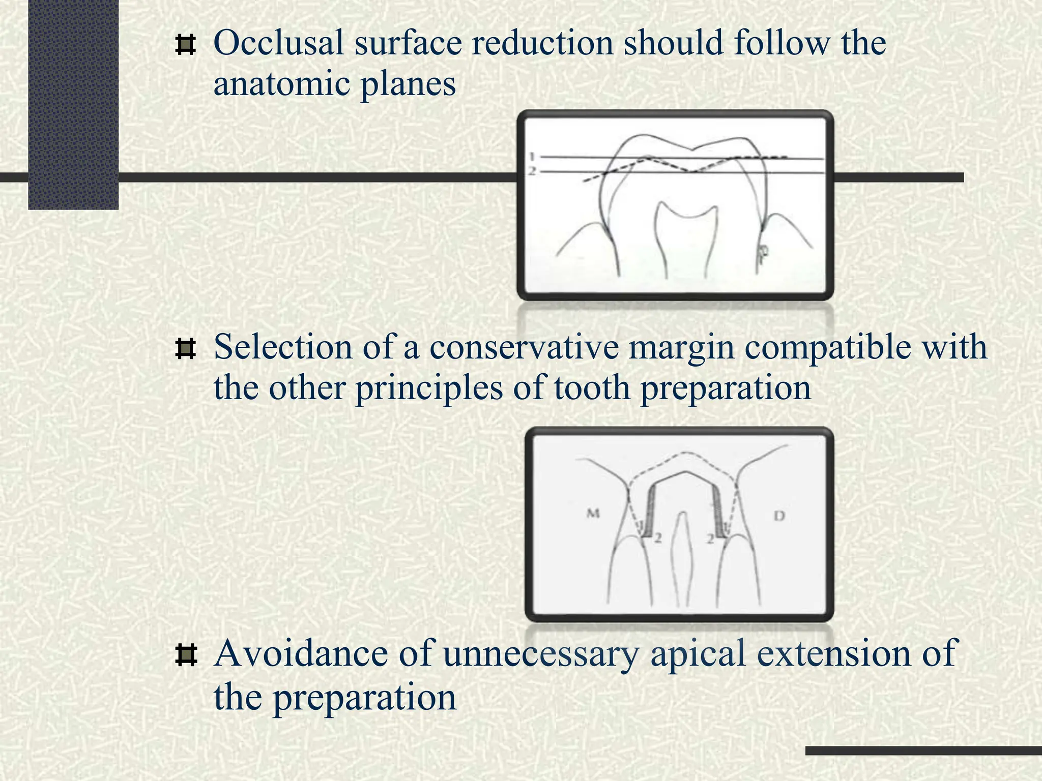 Biomechanical Principles of Tooth Preparation in FPD.ppt