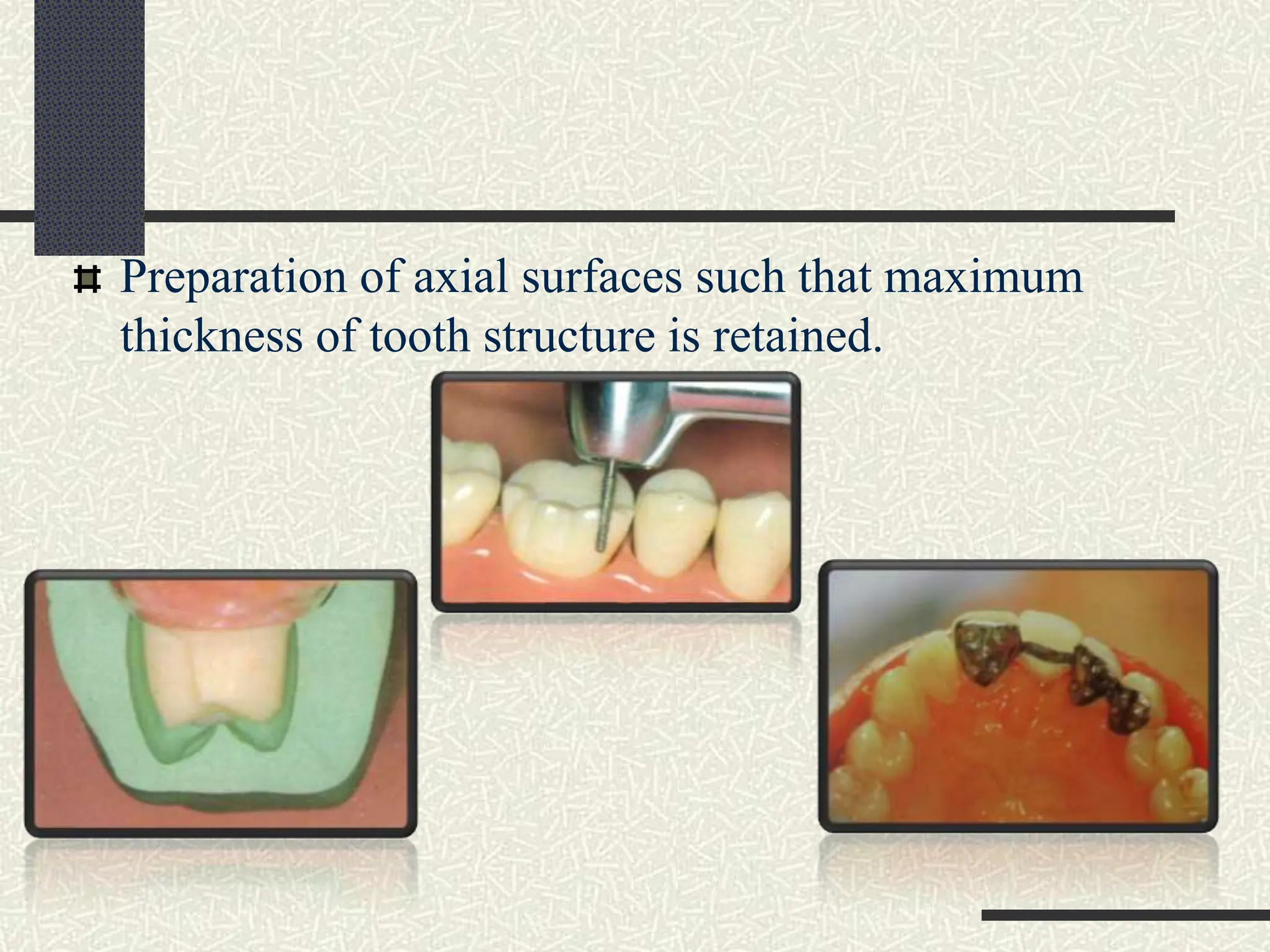 Biomechanical Principles of Tooth Preparation in FPD.ppt