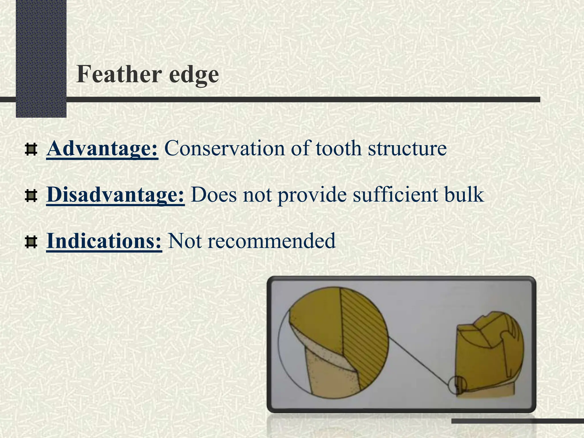 Biomechanical Principles of Tooth Preparation in FPD.ppt