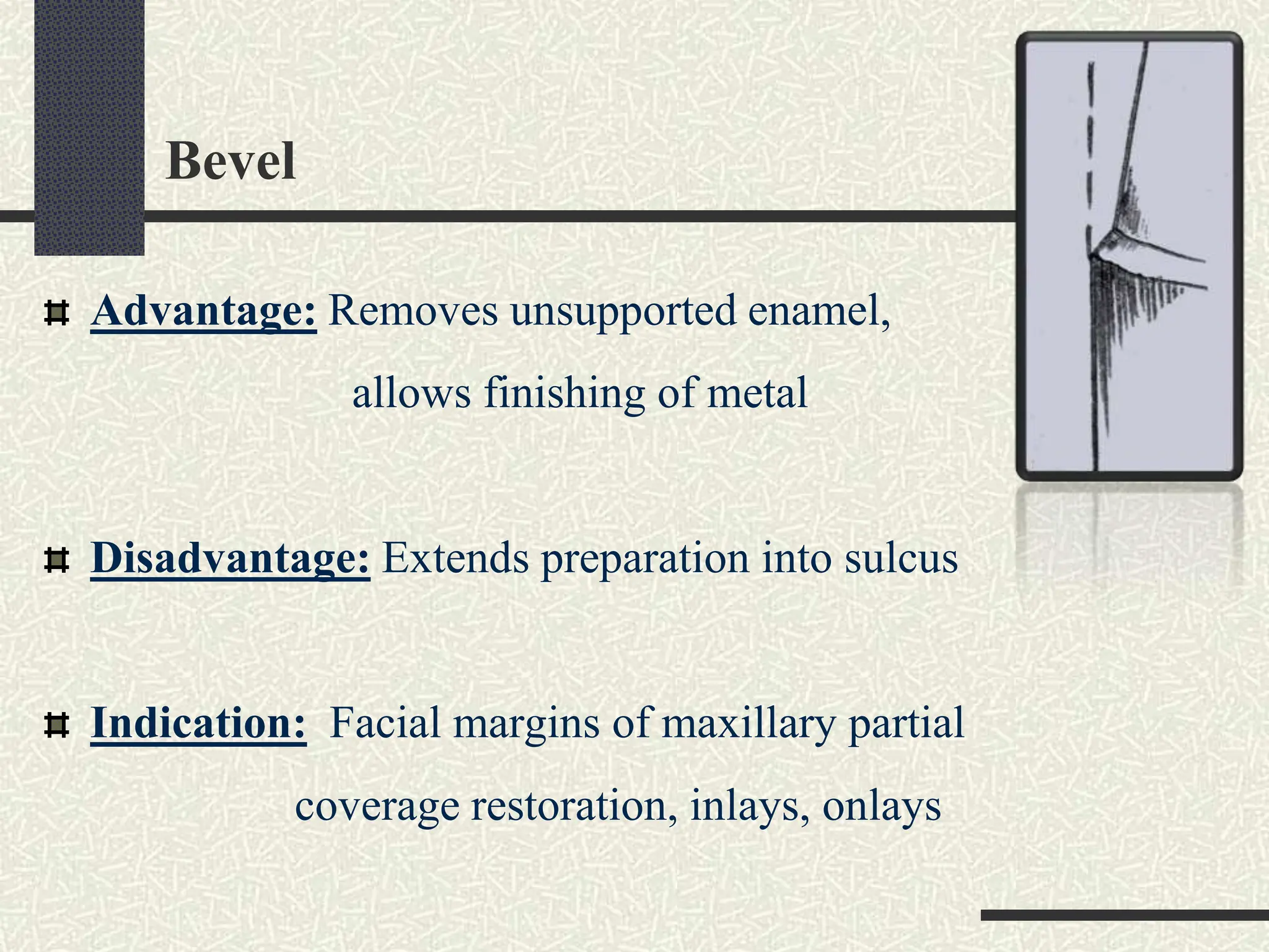 Biomechanical Principles of Tooth Preparation in FPD.ppt