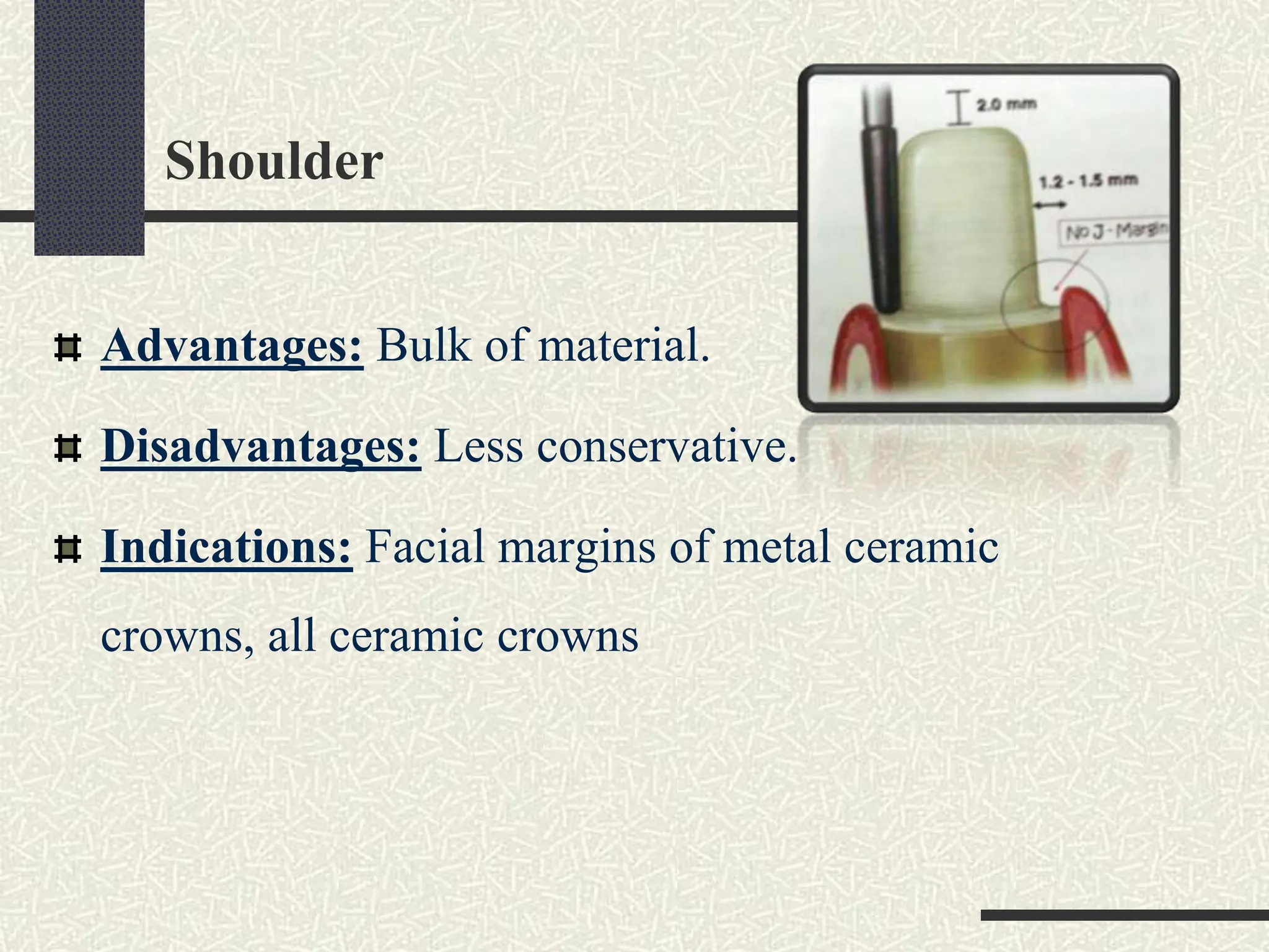 Biomechanical Principles of Tooth Preparation in FPD.ppt
