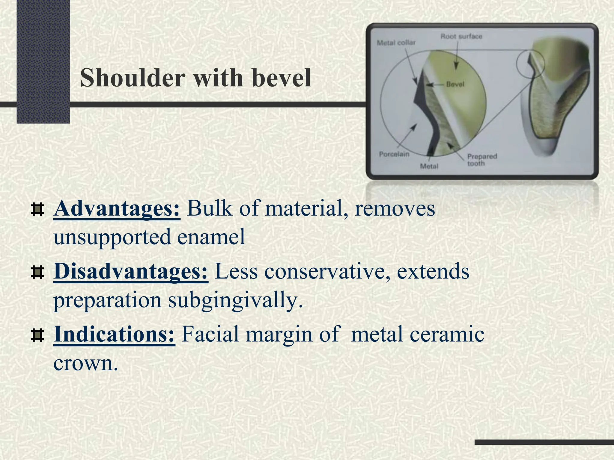 Biomechanical Principles of Tooth Preparation in FPD.ppt