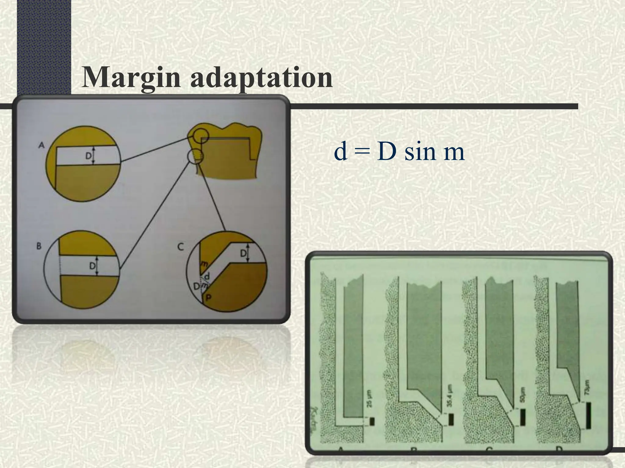 Biomechanical Principles of Tooth Preparation in FPD.ppt