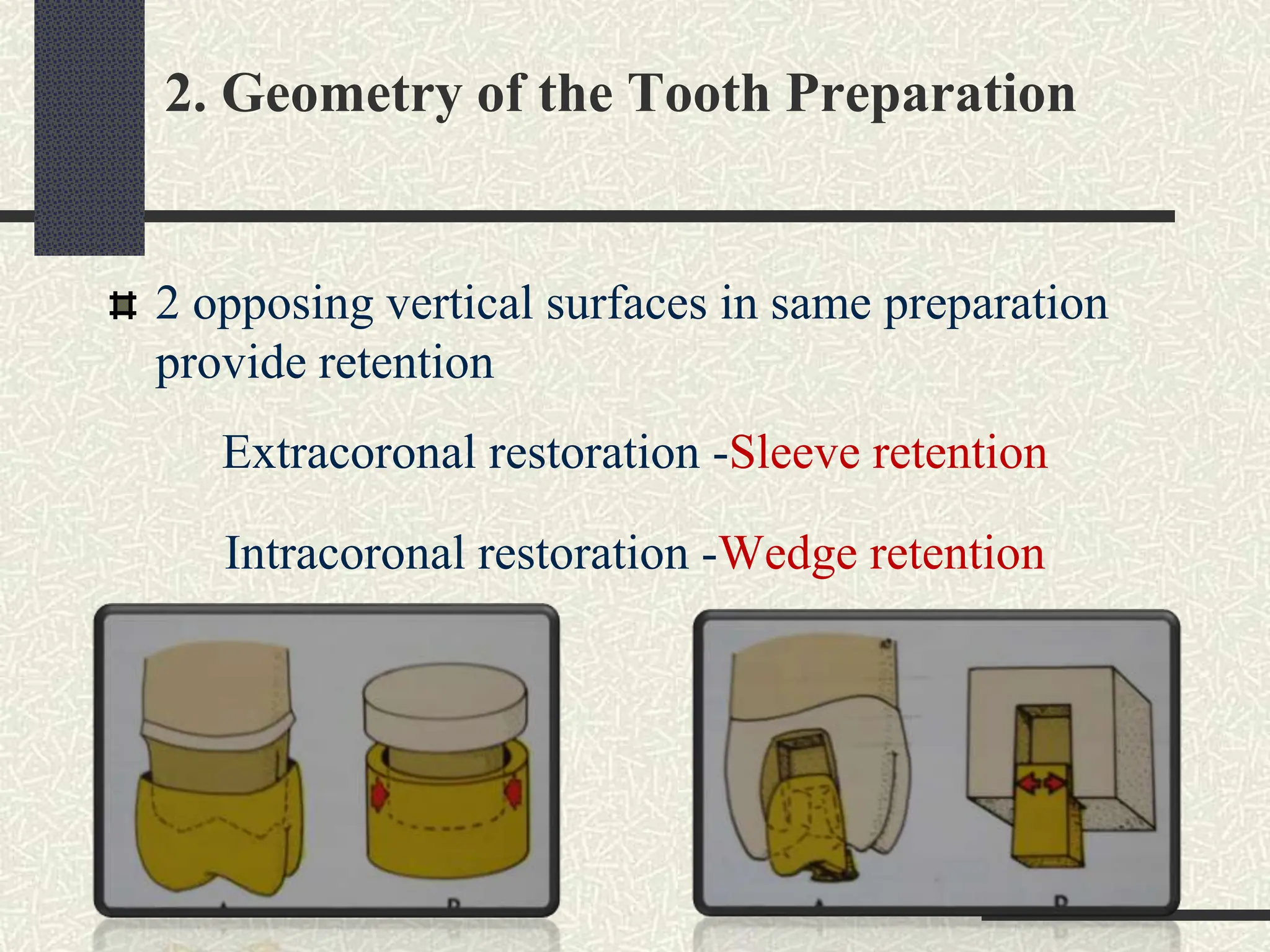Biomechanical Principles of Tooth Preparation in FPD.ppt